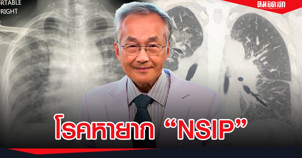 "โรคหายาก" NSIP โรคการอักเสบของเนื้อเยื่อในปอด แบบไม่ทราบสาเหตุ | คมชัดลึก