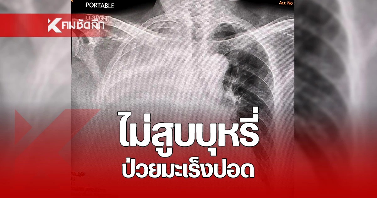 "หมอมนูญ" เล่าเคส ผู้ป่วยชาย 69 ปี ไม่สูบบุหรี่ เป็นมะเร็งปอดระยะ ...